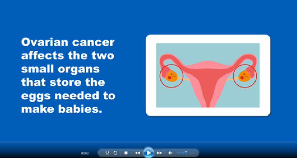 Ovarian cancer signs and symptoms animation - Greater Manchester Cancer